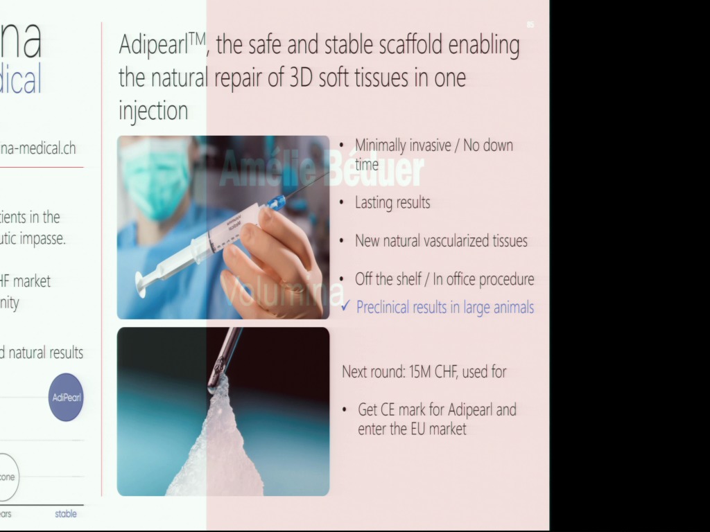 Volumina Medical SA - startup.ch